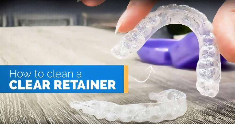 How to Clean Retainers: Avoid Common Mistakes